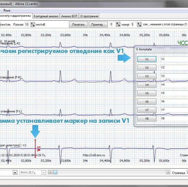 Домашний ECG Lite в Москве, цена 5 500 руб. | Объявления о продаже в ...